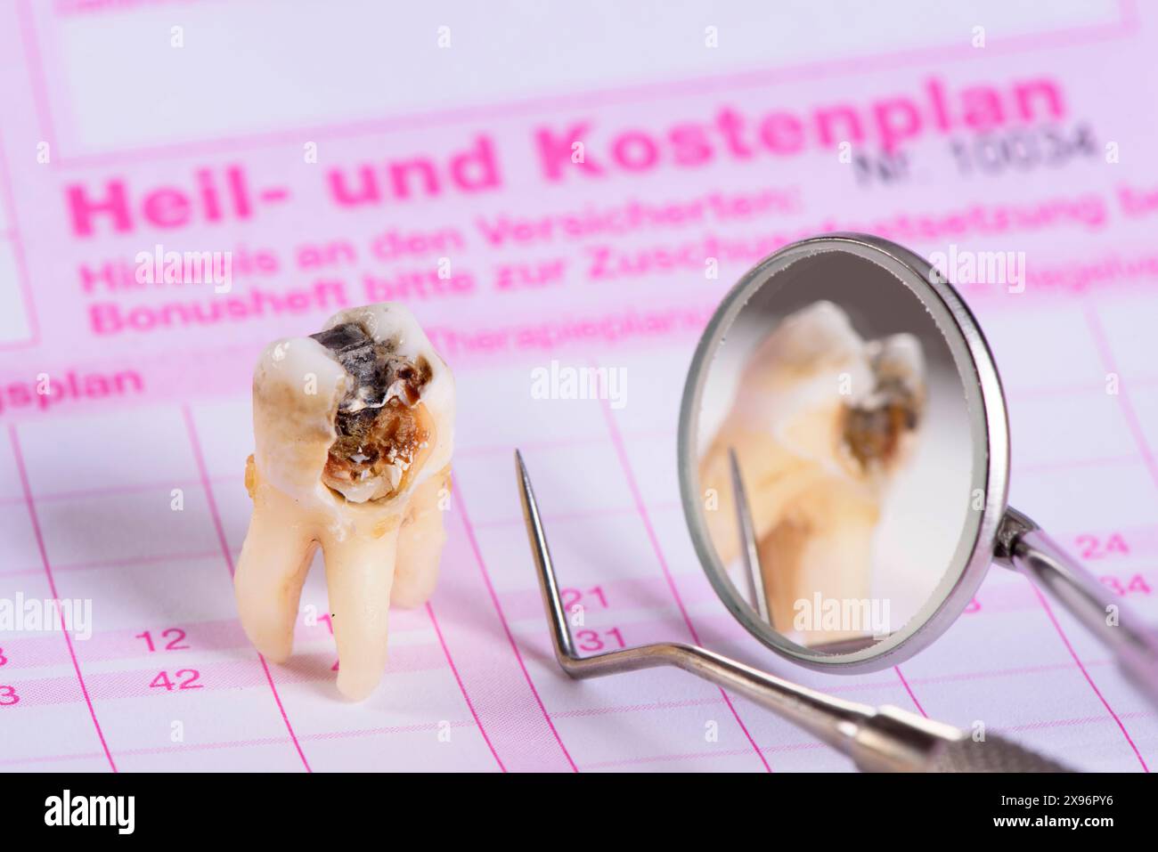 Backenzahn mit Karies und Amalgamfüllung Auf einem Heil- und Kostenplan ...