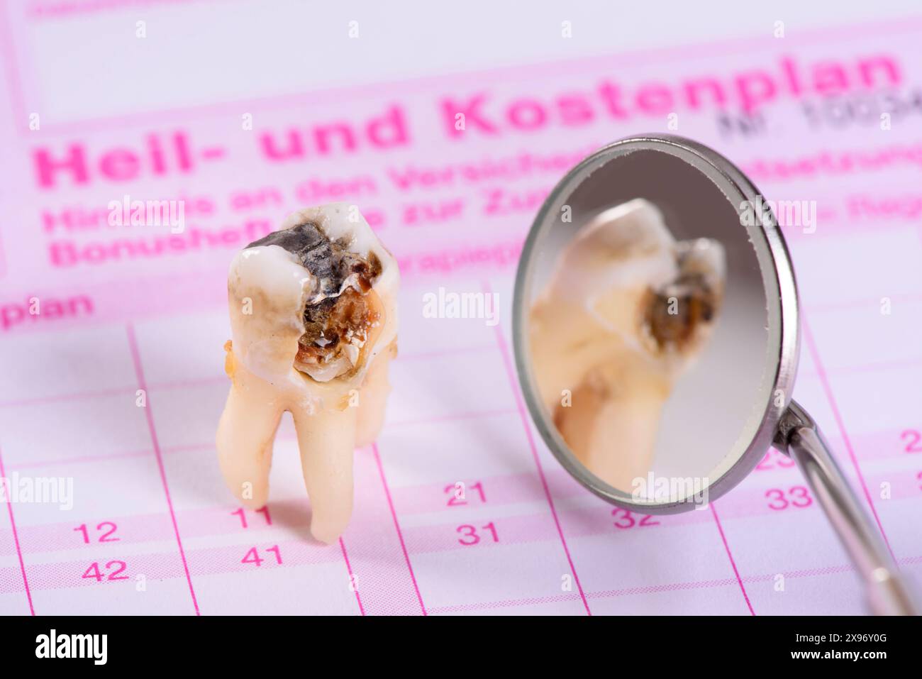 Backenzahn mit Karies und Amalgamfüllung Auf einem Heil- und Kostenplan ...