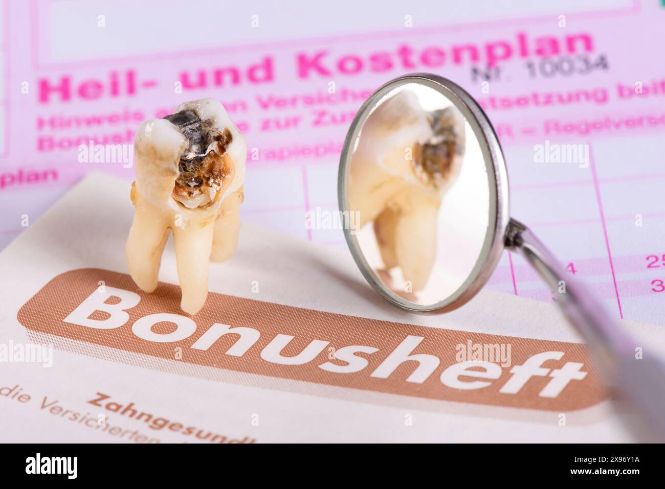 Backenzahn mit Karies und Amalgamfüllung Auf einem Heil- und Kostenplan ...