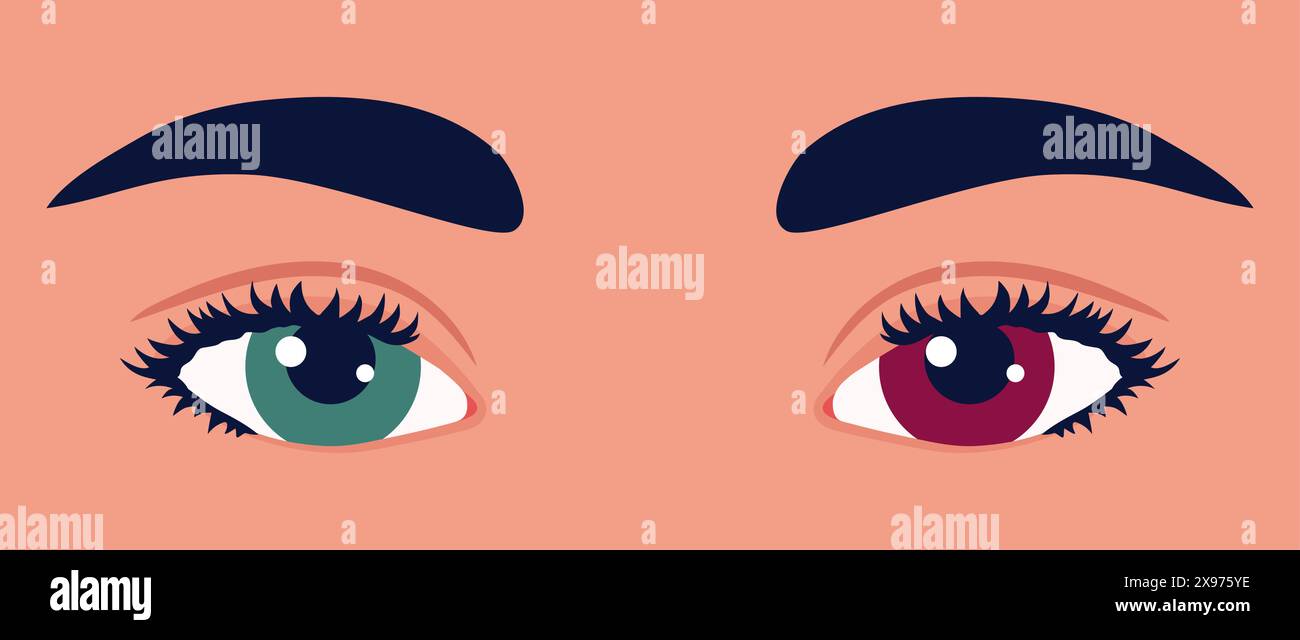 Different colored eyes close up. Heterochromia. Green blue and brown ...