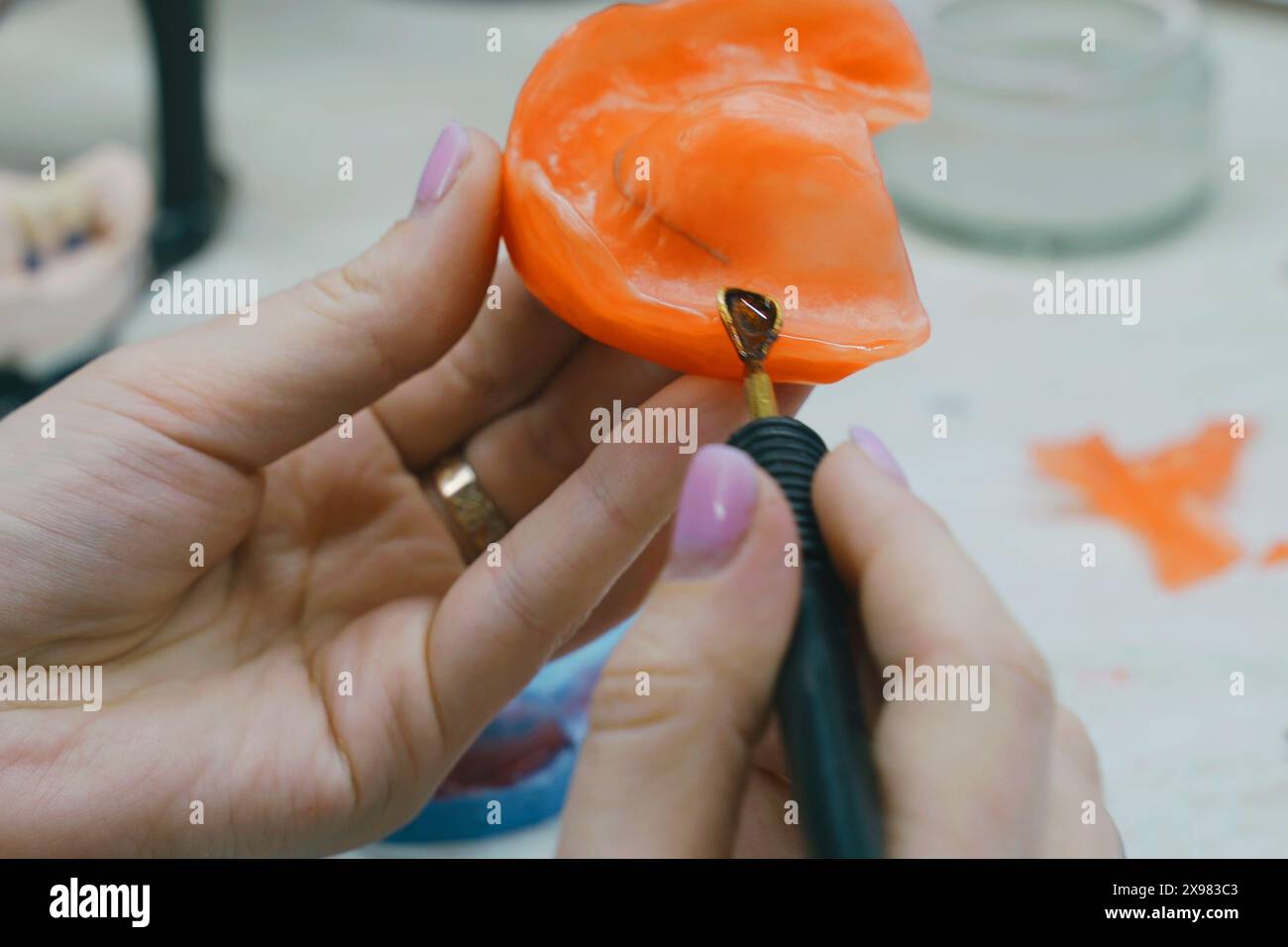 The dental technician makes a wax base and adds wax to form the mold ...