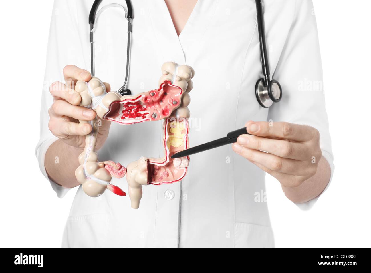 Doctor showing model of large intestine on white background, closeup ...