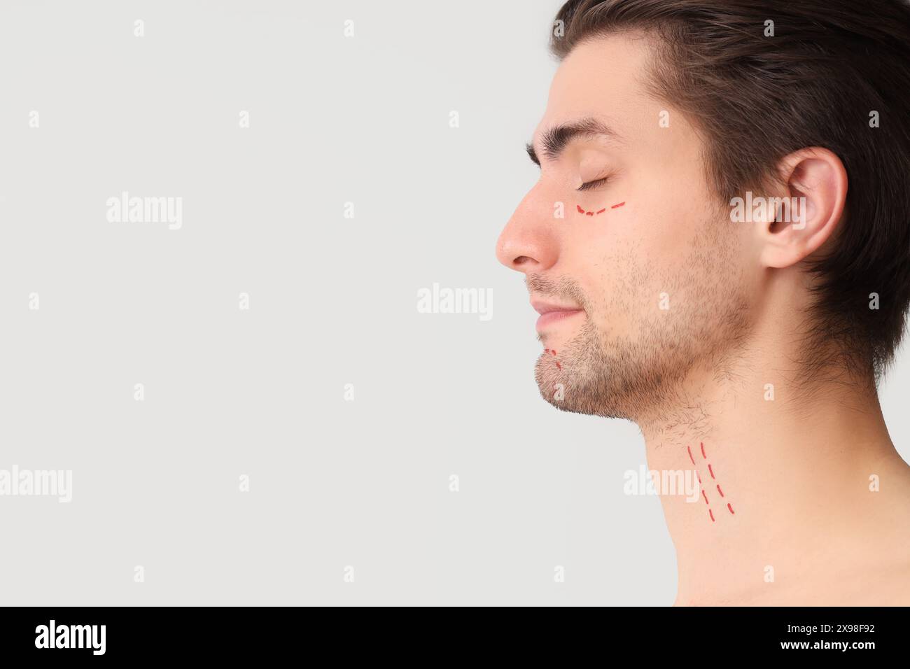 Young man with marked face on light background, closeup. Plastic ...