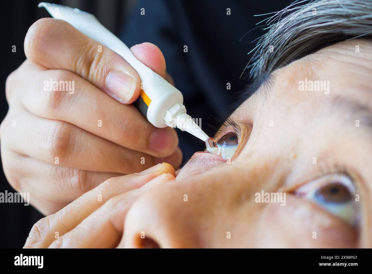 Doctor apply artificial tears gel to senior woman patient eye for ...