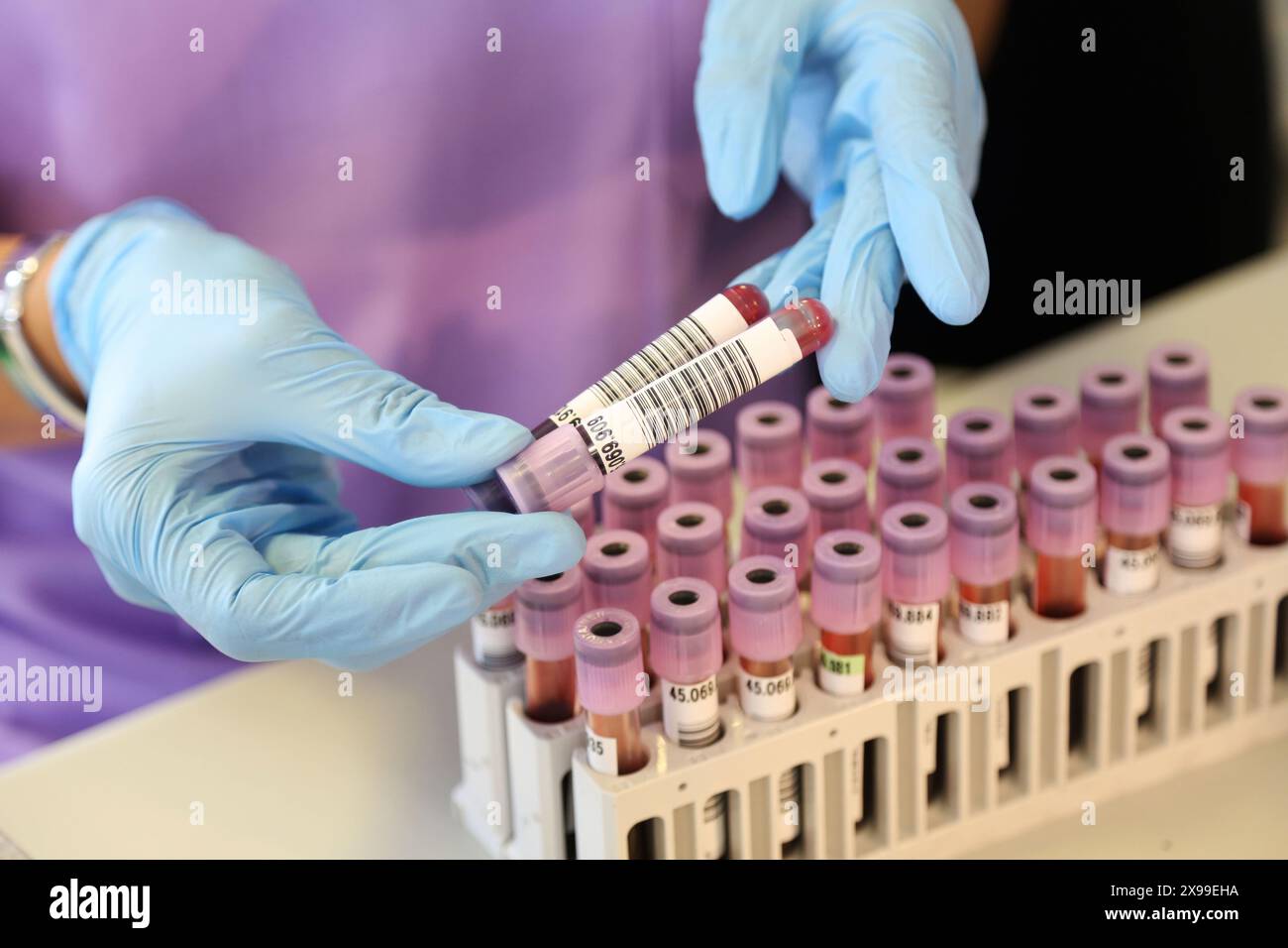 Complete blood count cbc test hi-res stock photography and images - Alamy