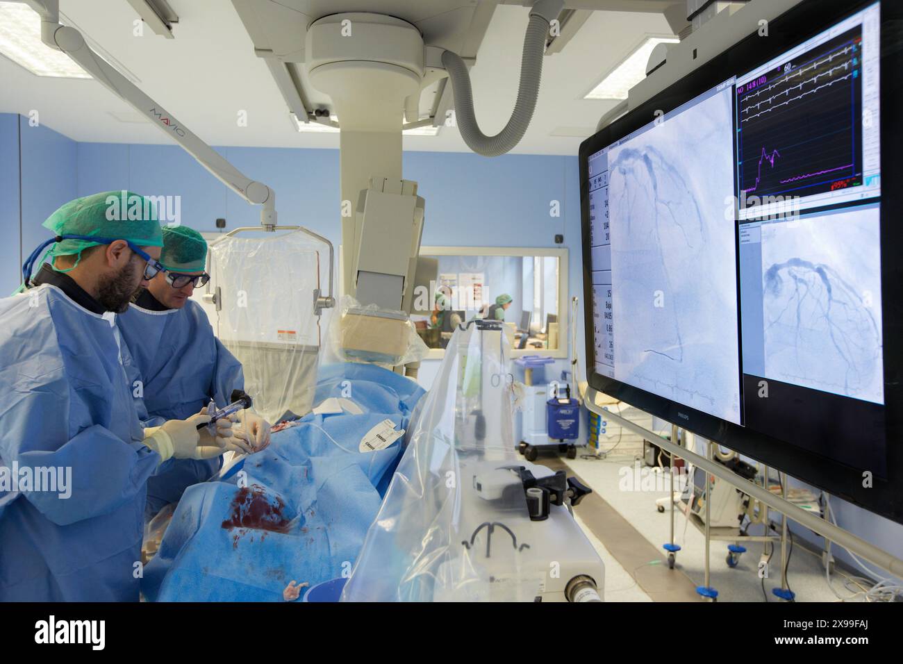 Angioplasty, Stenting in coronary arteries, Hemodynamic, Operating room ...