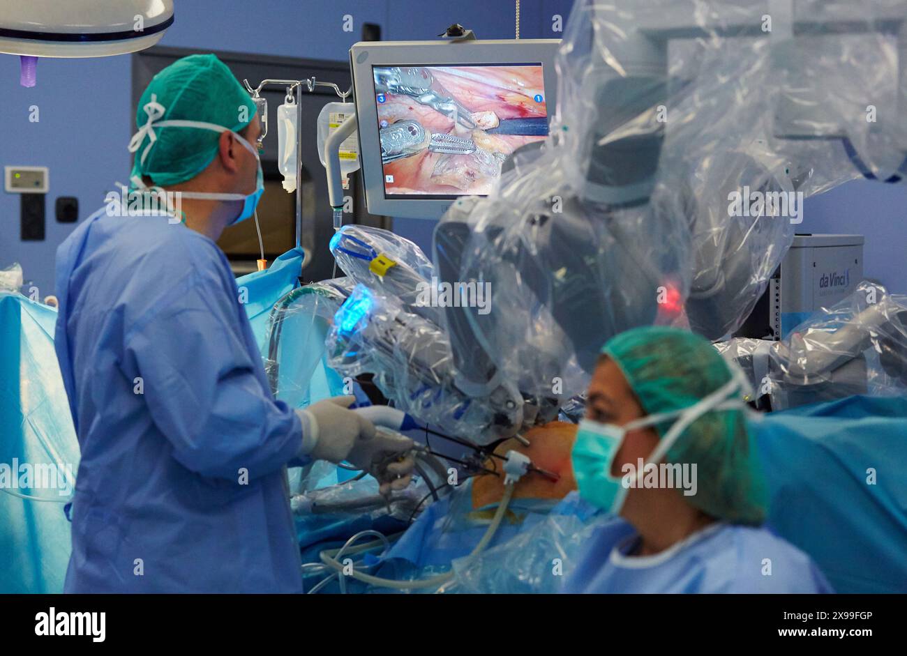 Operating room, Prostate cancer robotic surgery, Da Vinci surgical ...