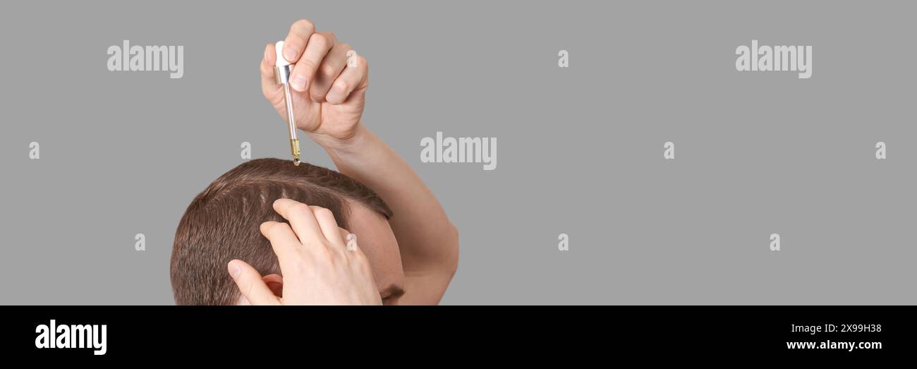 Man baldness treatment. Anti hairloss clinic mask. Nature hair care ...