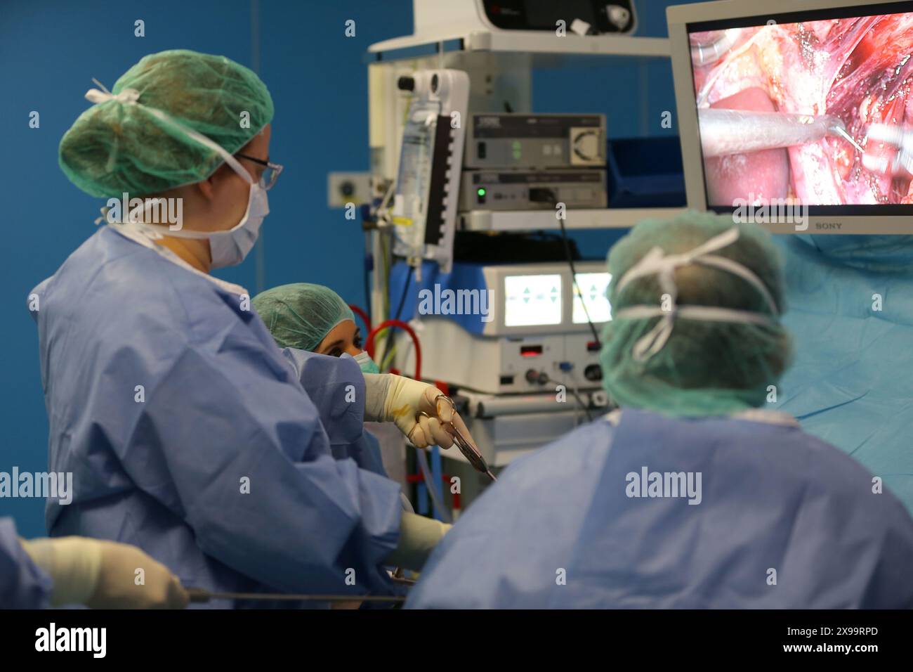 Hiatal hernia surgery hi-res stock photography and images - Alamy