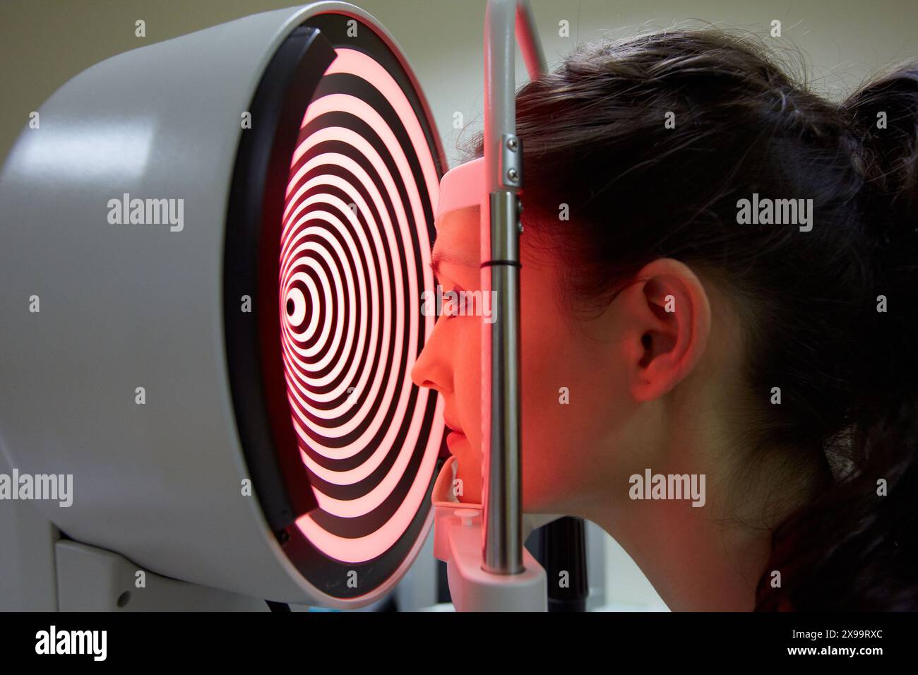 Eye defects hi-res stock photography and images - Alamy