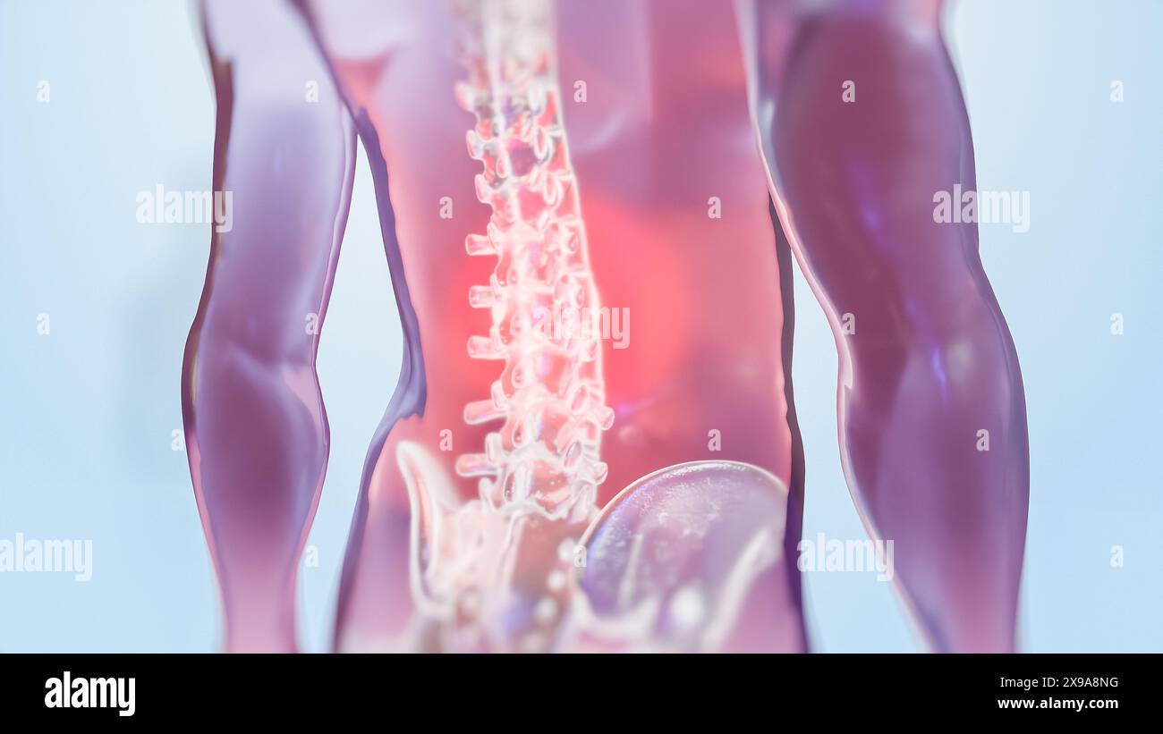 VFX Back Pain Virtual Reality Presentation Render. Digitally Generated ...