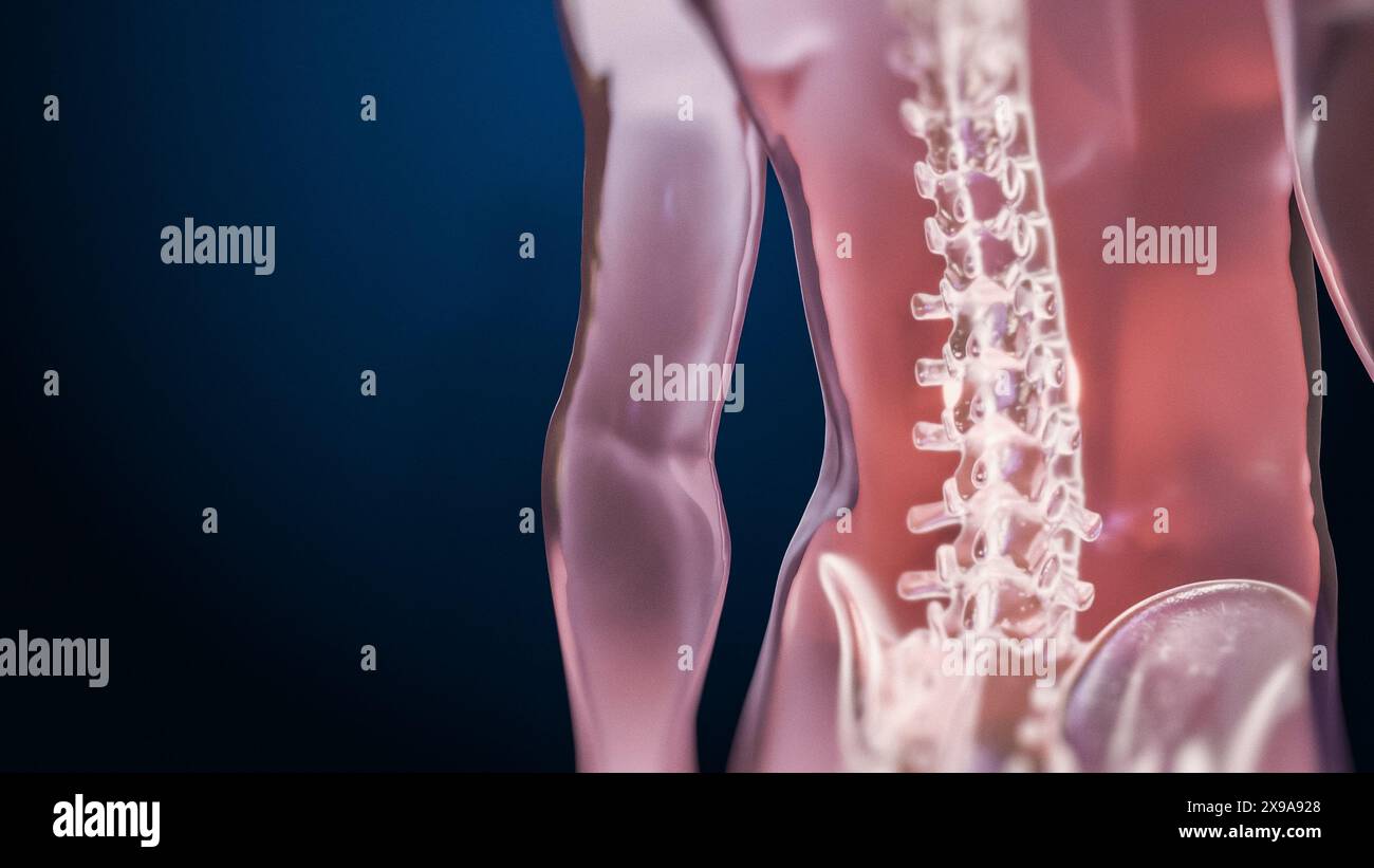 VFX Back Pain Virtual Reality Presentation Render. Digitally Generated ...