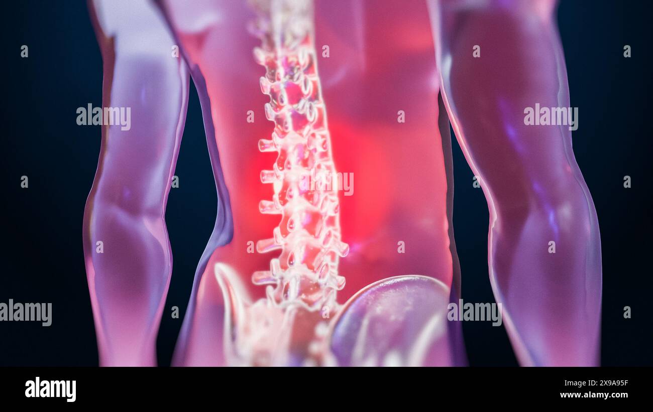 VFX Back Pain Virtual Reality Presentation Render. Digitally Generated ...