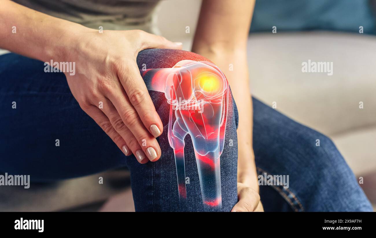 VFX Joint and Knee Pain Augmented Reality Render. Close Up of a Person ...
