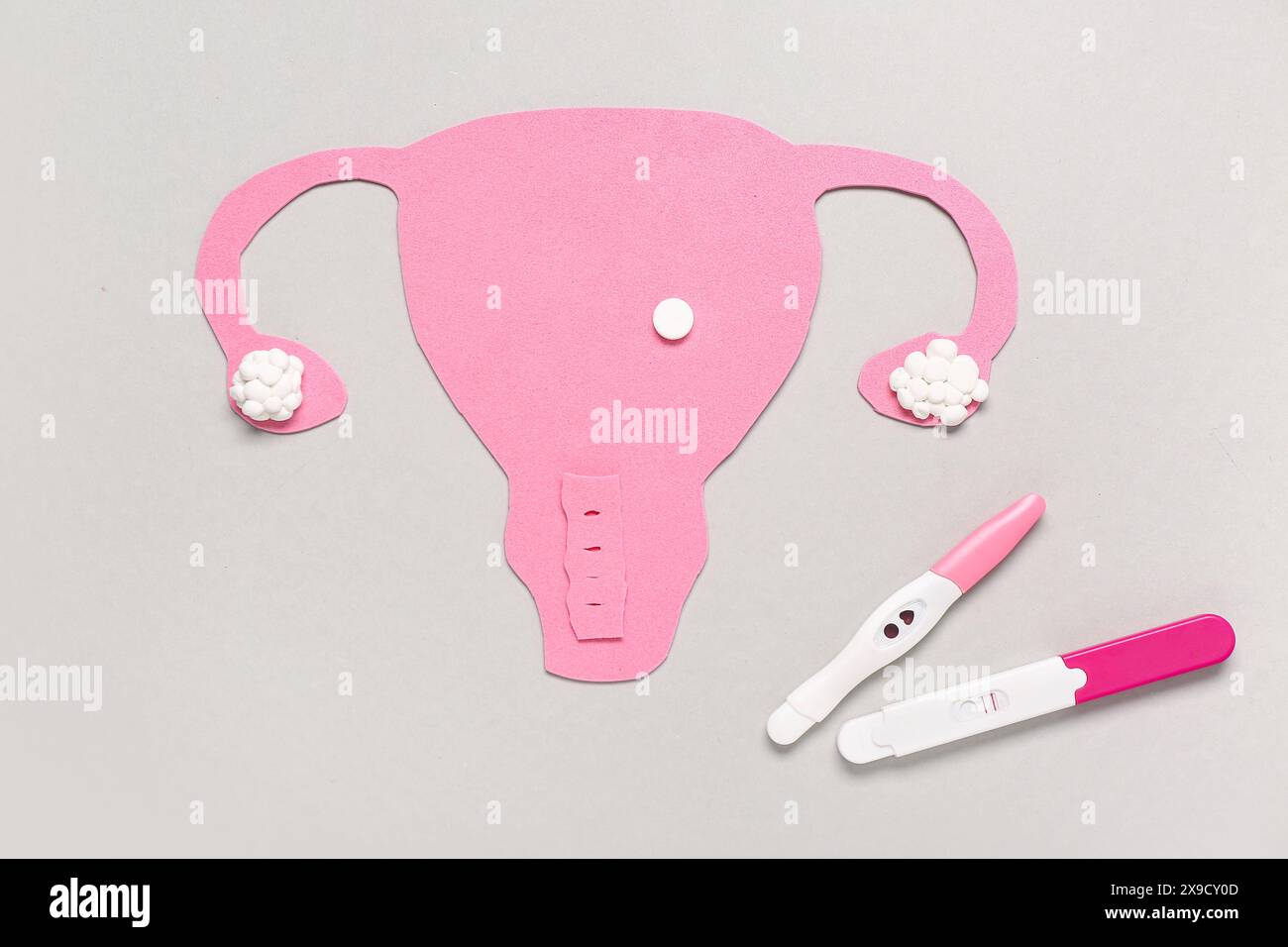 Paper uterus with pill and pregnancy tests on grey background Stock ...