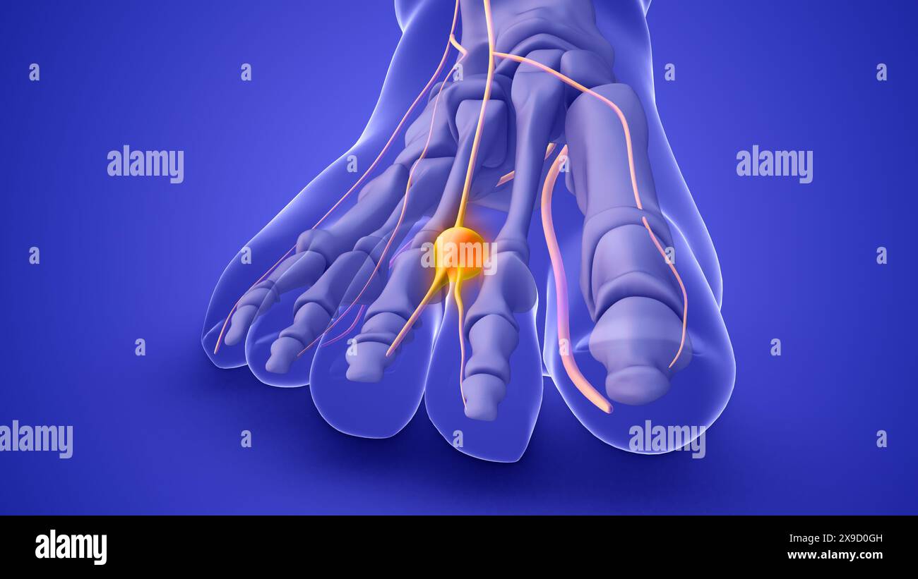 Anatomy of plantar nerve hi-res stock photography and images - Alamy