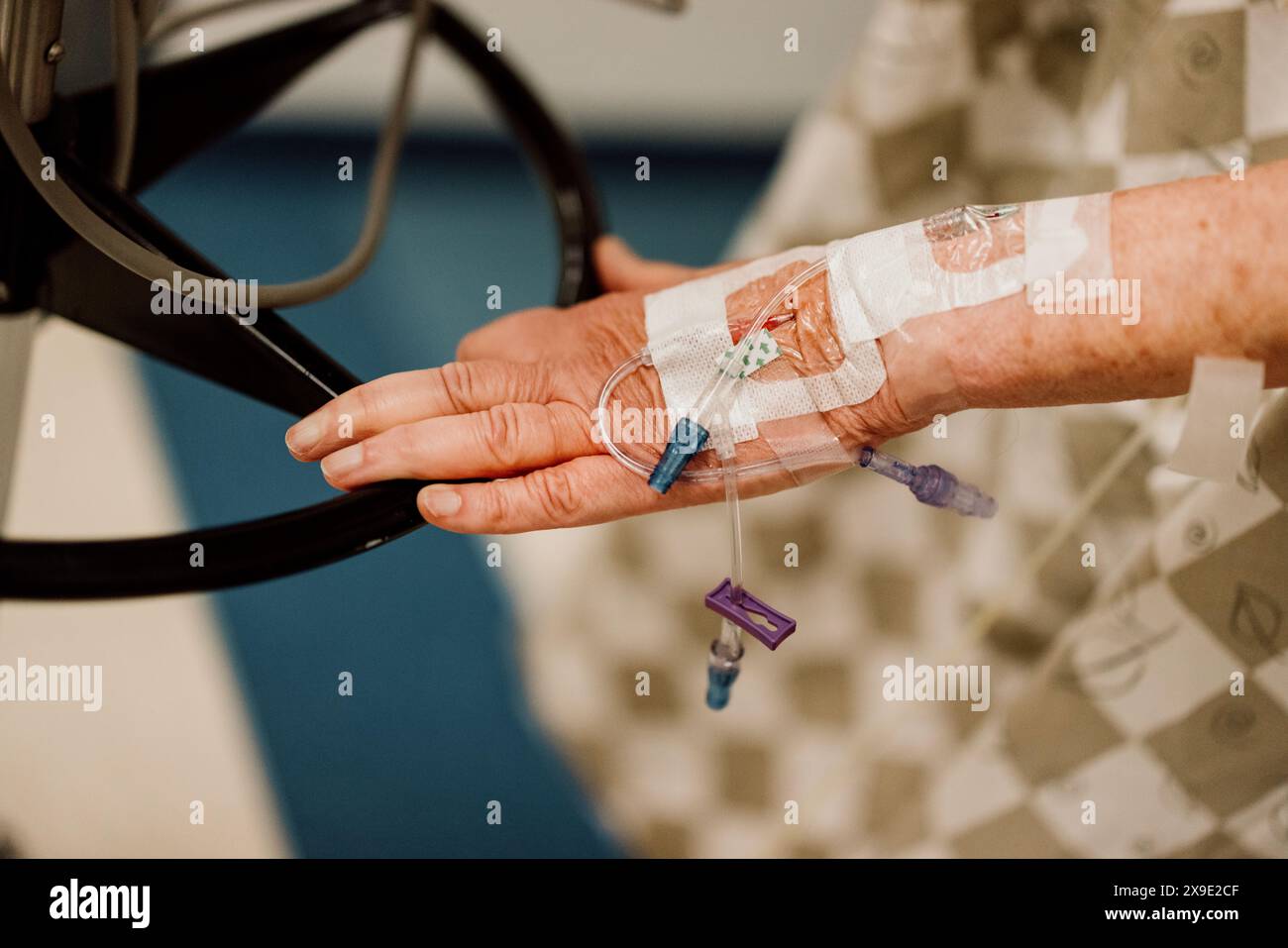 detail of IV lines going into elderly cancer patient's hands Stock ...