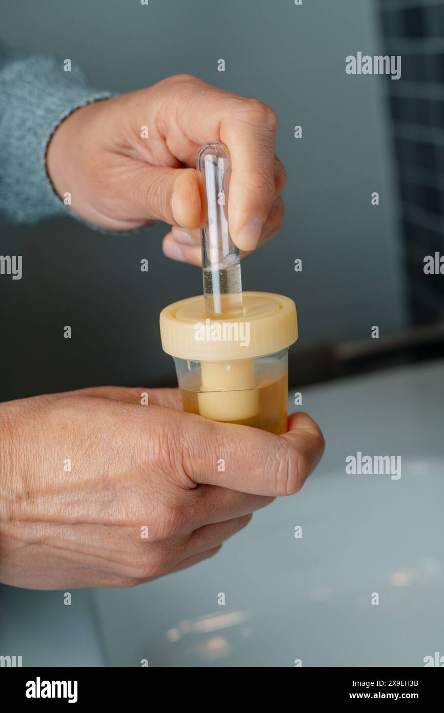 closeup of a man in the bathroom filling a tube with a urine sample ...