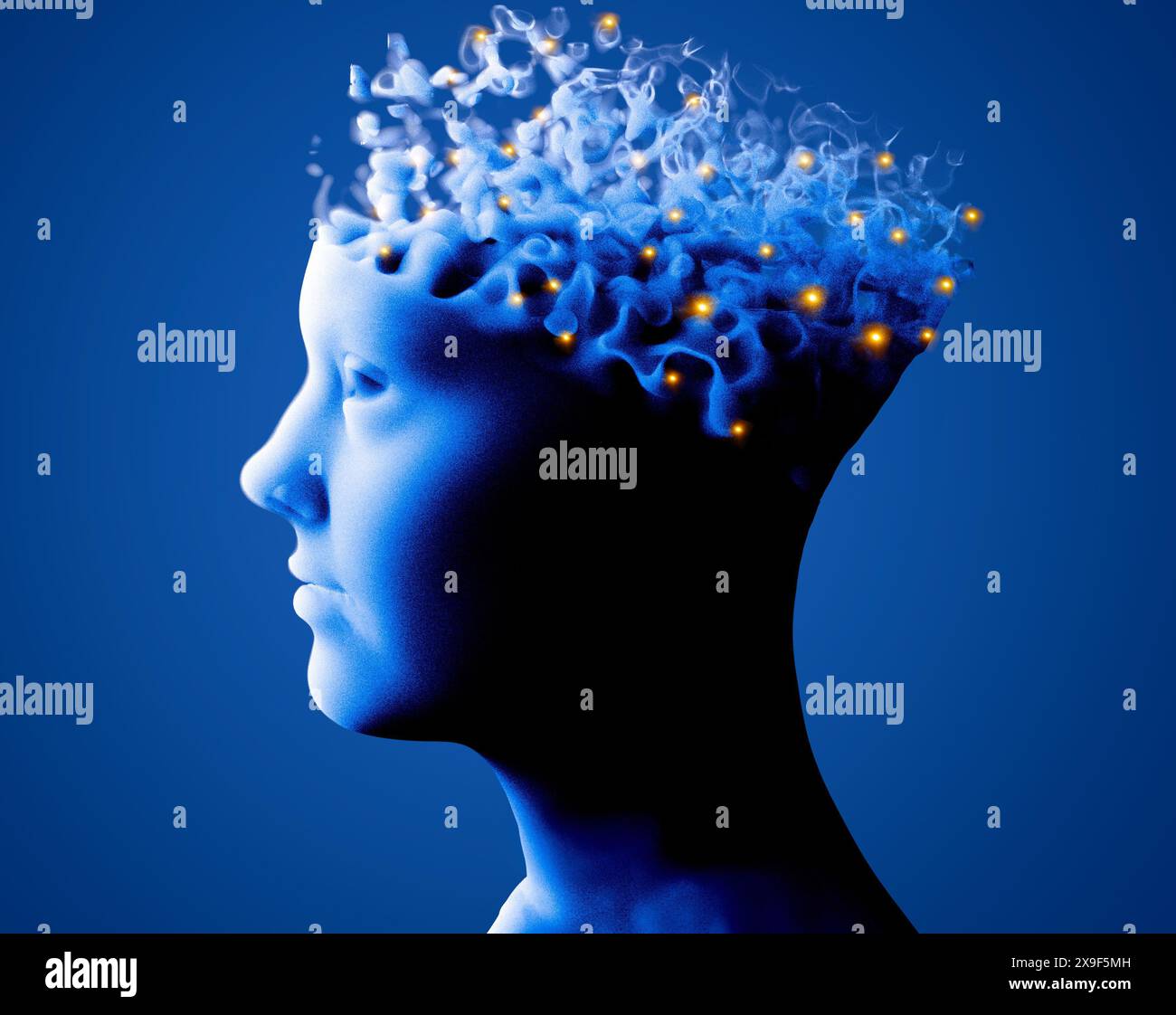 Face seen from the side. Degenerative disease. Brain degenerative ...