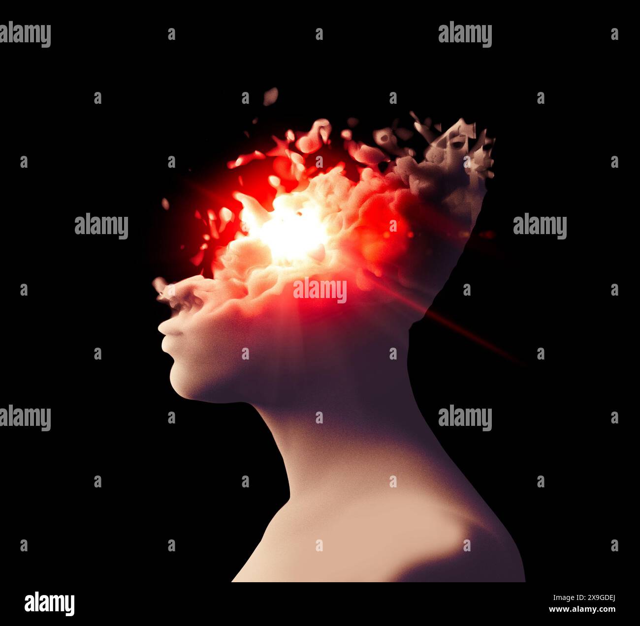 Face seen from the side. Woman, degenerative disease. Brain ...