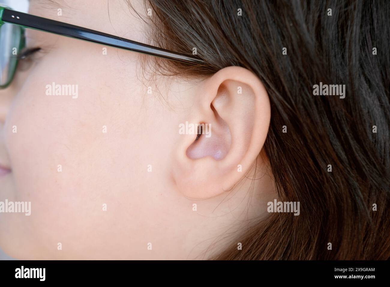 part face of boy, Child, ear Organ of Hearing, Auditory System close up ...