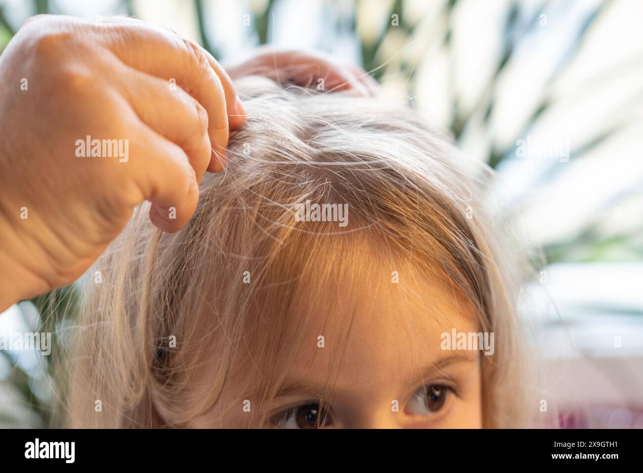 Close-up child's head with female hands searching for lice and nits in ...