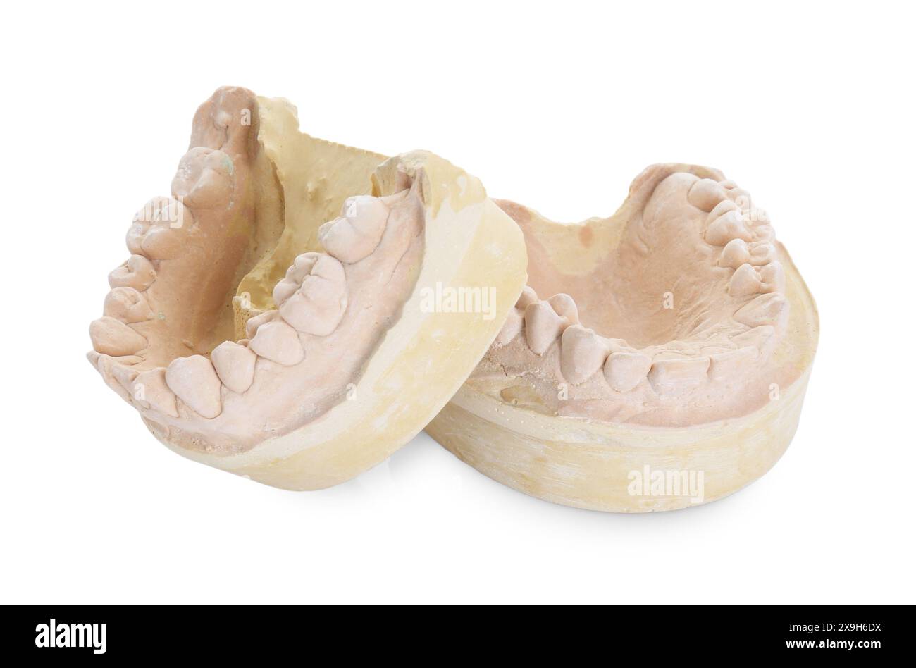 Dental model with jaws isolated on white. Cast of teeth Stock Photo - Alamy