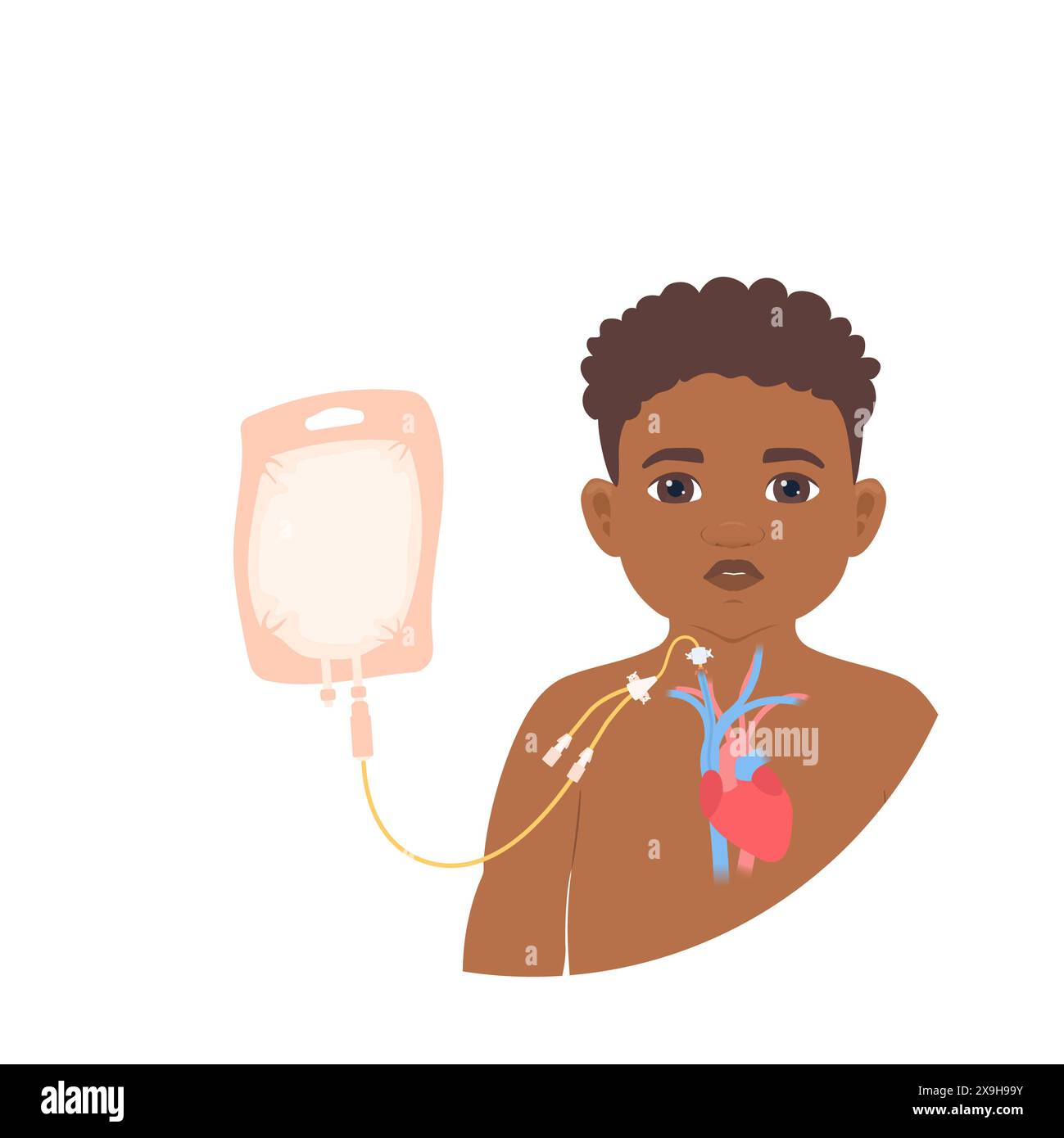 Total parenteral nutrition hi-res stock photography and images - Alamy