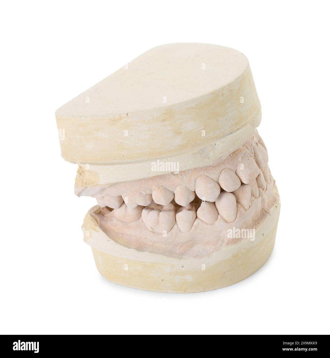 Dental model with jaws isolated on white. Cast of teeth Stock Photo - Alamy