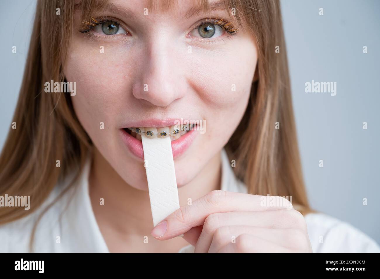 Young woman with metal braces on her teeth is chewing gum. The girl is ...