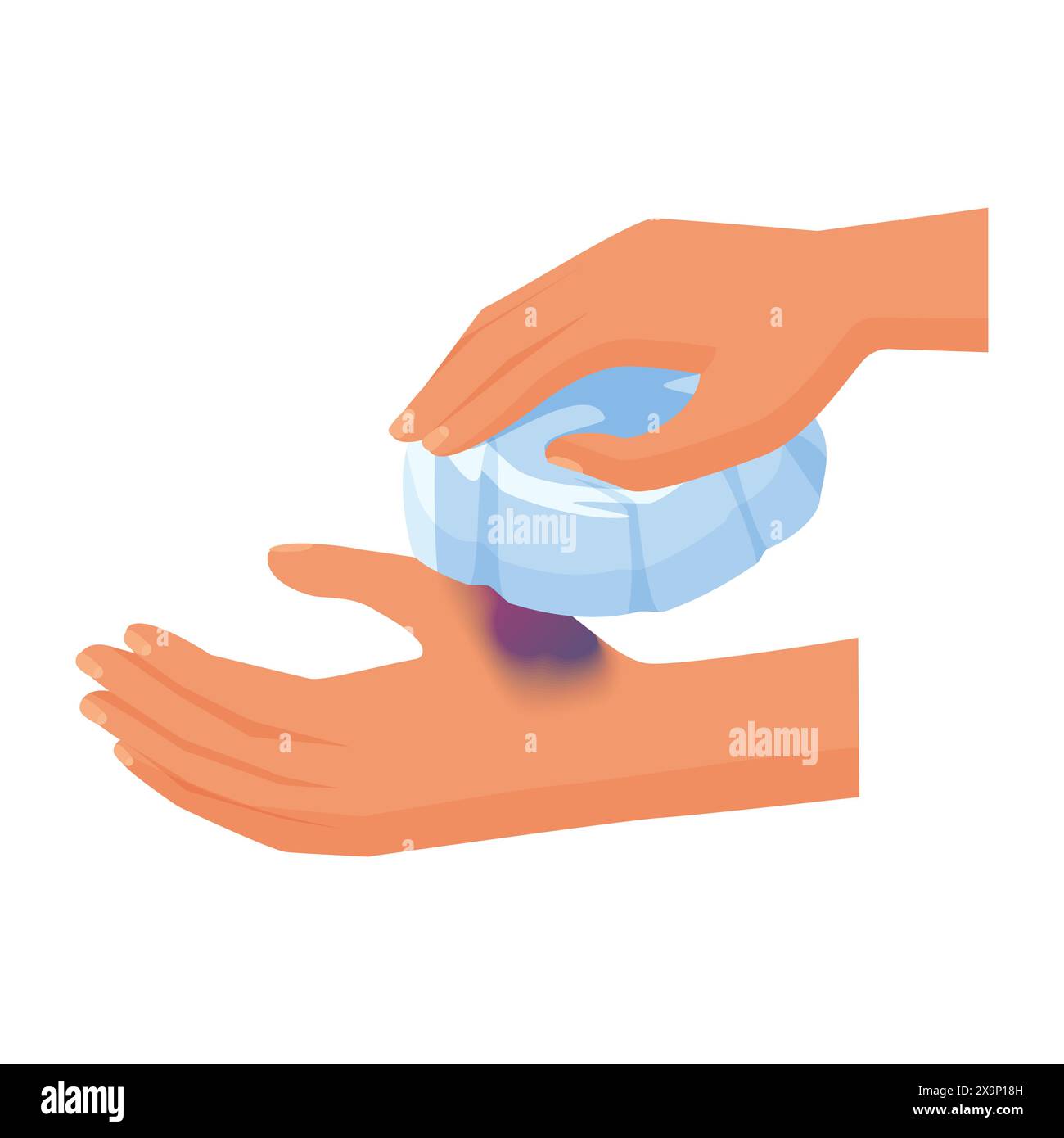 Hands apply ice pack to cool bruise on arm, first aid for bruised hand ...