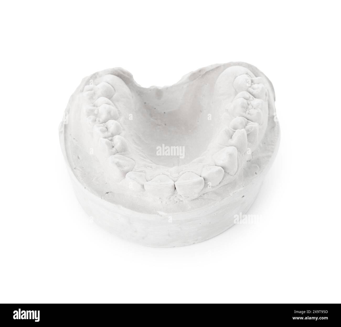 Dental model with jaw isolated on white. Cast of teeth Stock Photo - Alamy