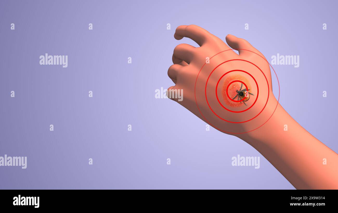 Lyme hand red cells animation Stock Photo - Alamy