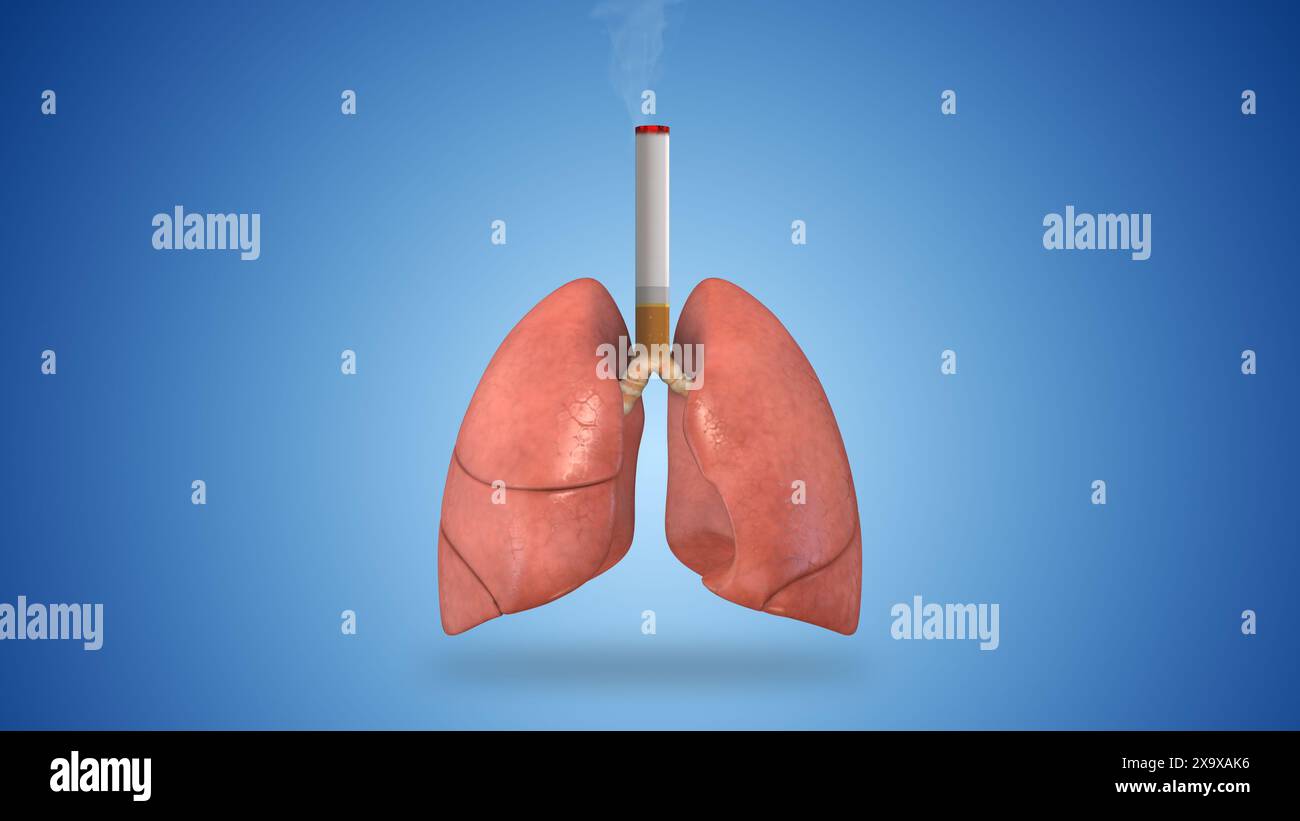 Damaged human lungs with a cigarette Stock Photo - Alamy
