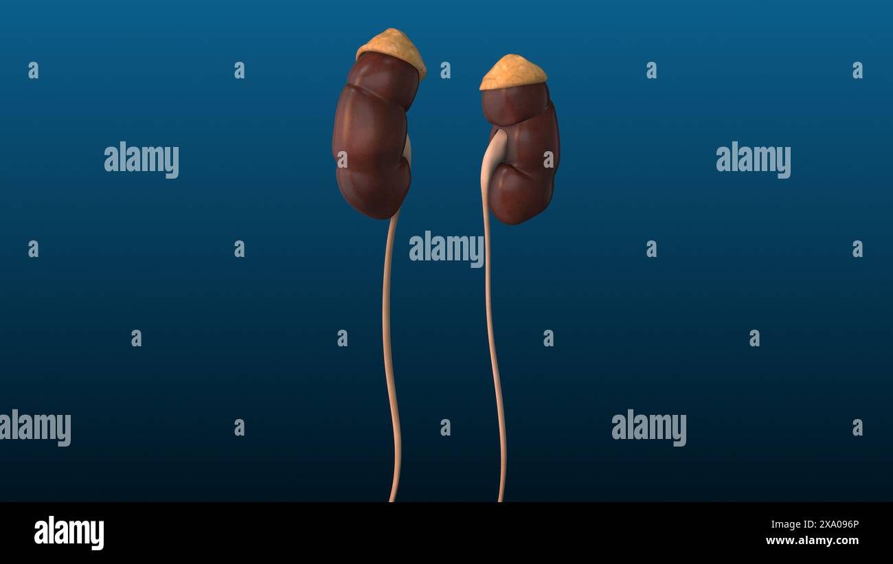 Concept animation for urinary tract infection Stock Photo - Alamy