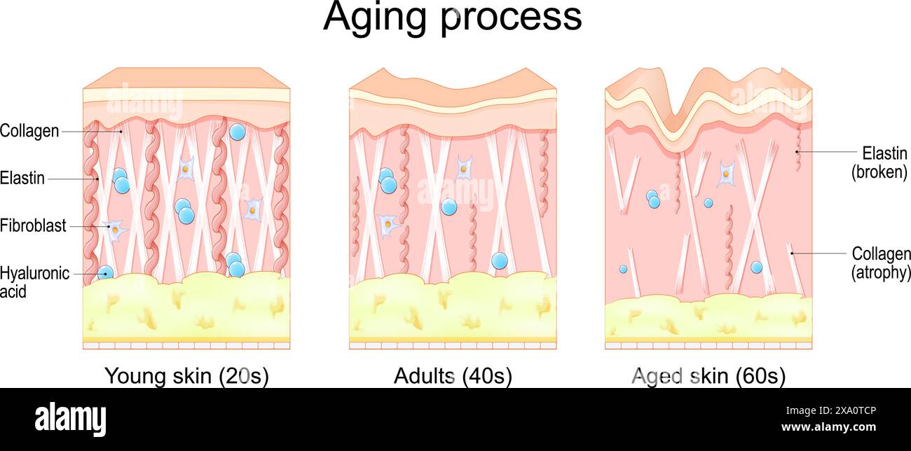 Aging process. Comparison of Young, Adults and aged skin. Collagen ...
