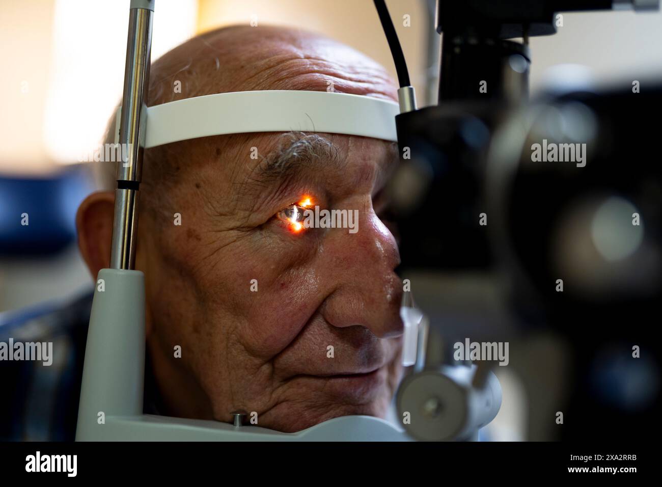 Cecil Farley has his artificial cornea examined as Frimley Health ...
