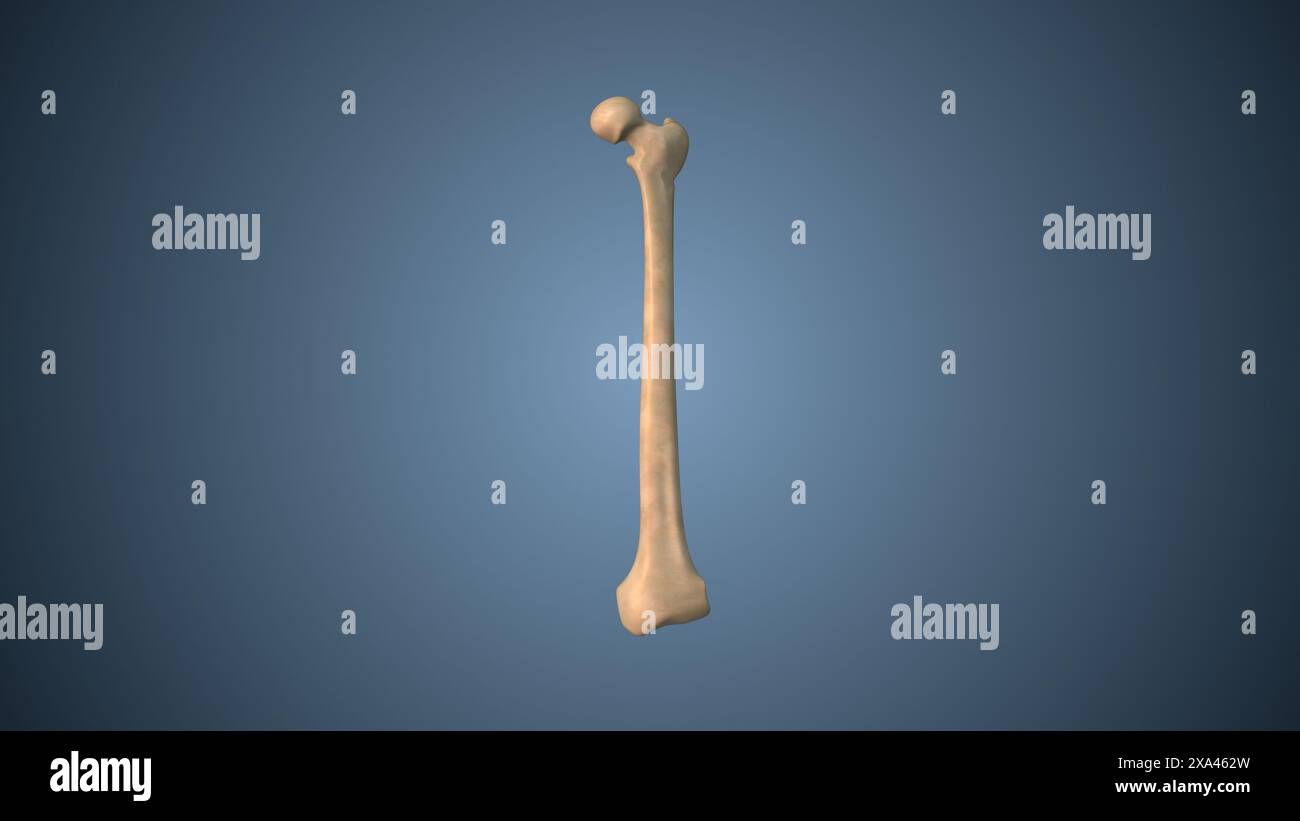 Medical concept cracked bone hi-res stock photography and images - Alamy