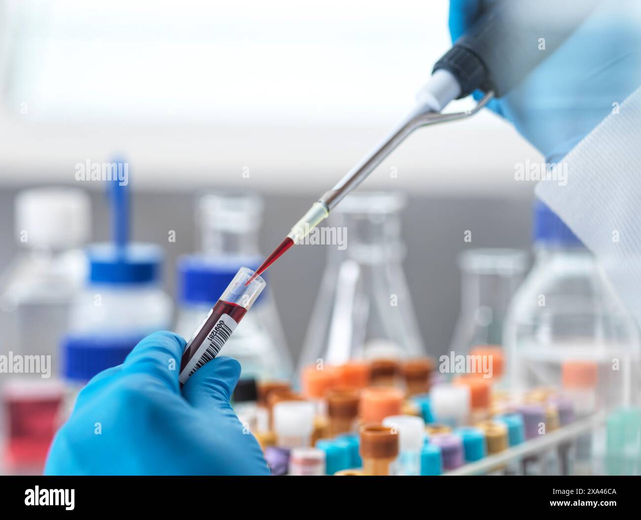 Blood sample of hi-res stock photography and images - Alamy