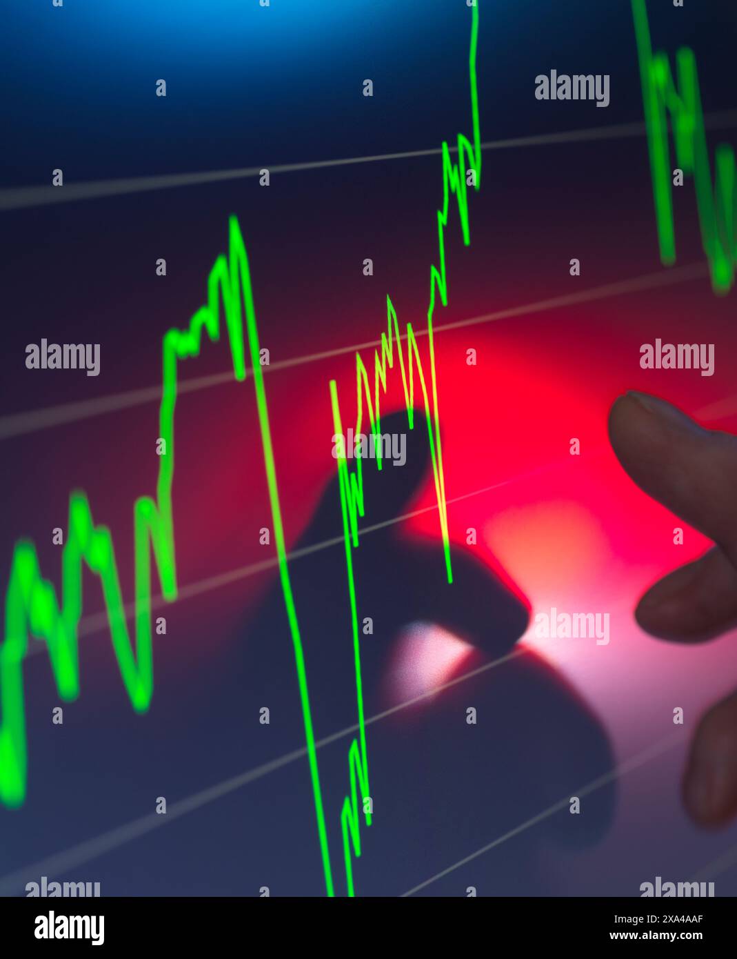 A hand points to a monitor displaying green stock market graphs, with a ...