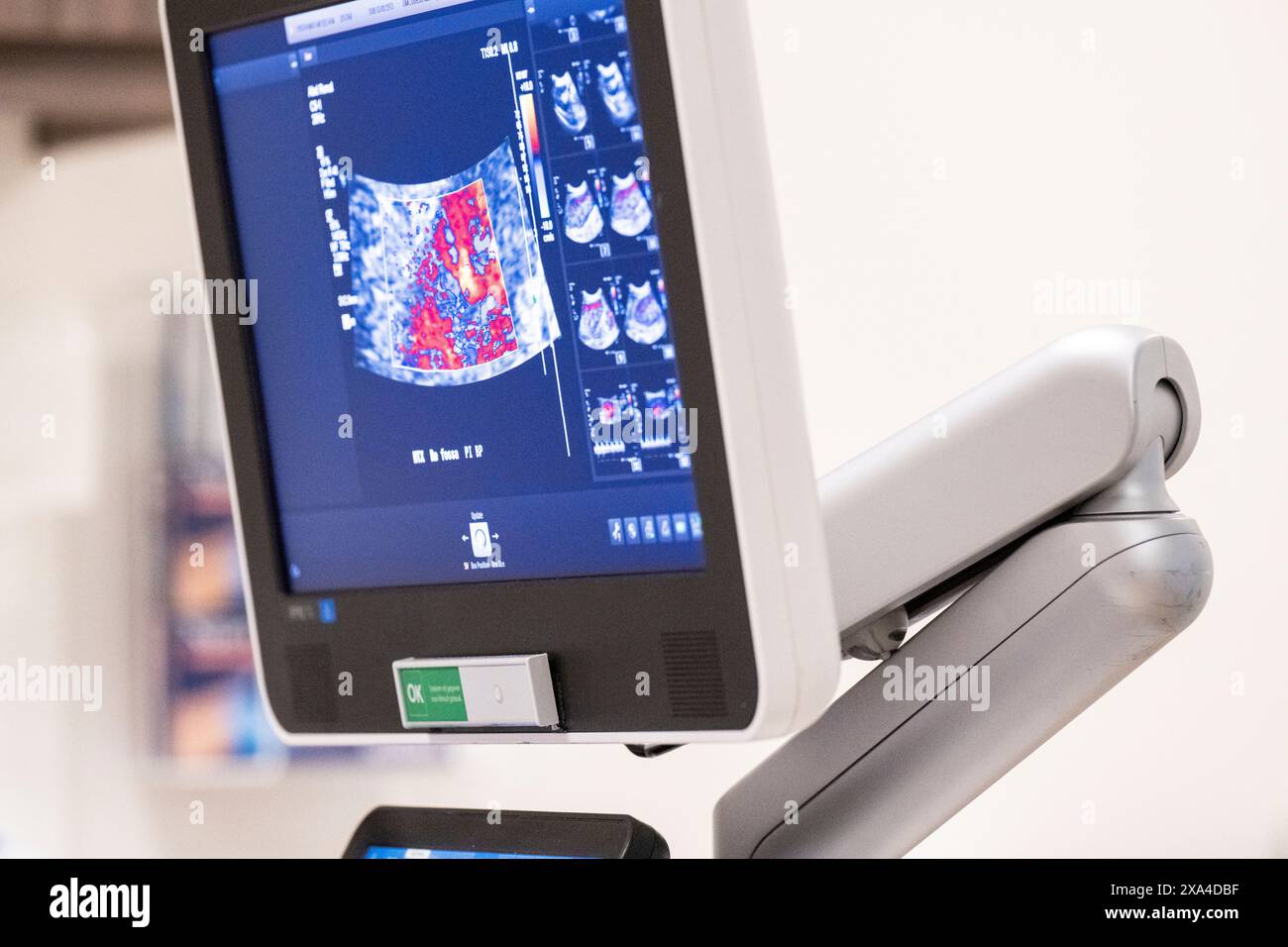 An ultrasound machine's monitor displays a colorful Doppler image ...