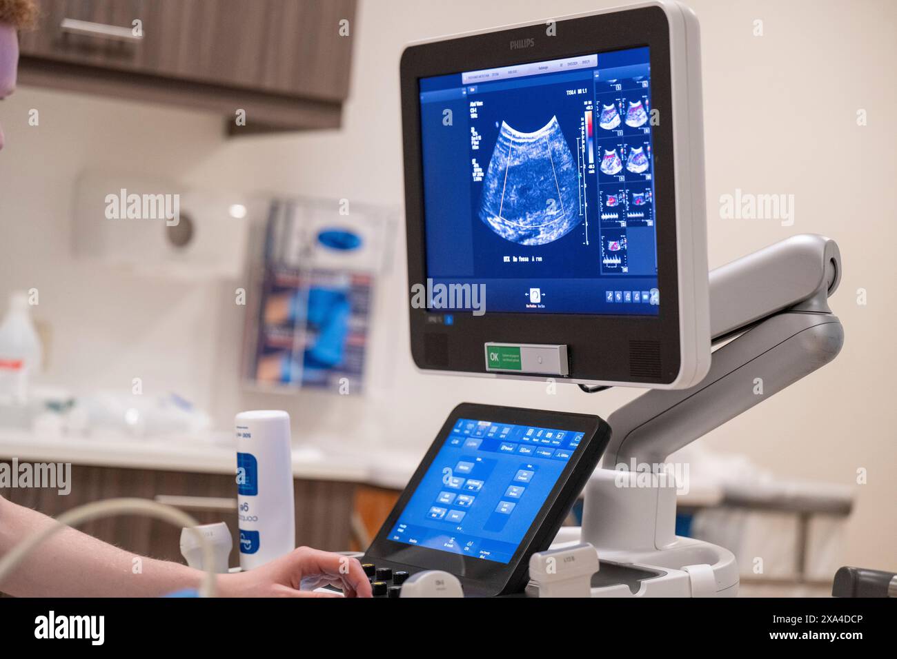 An ultrasound machine with a live scan displayed on the monitor in a ...