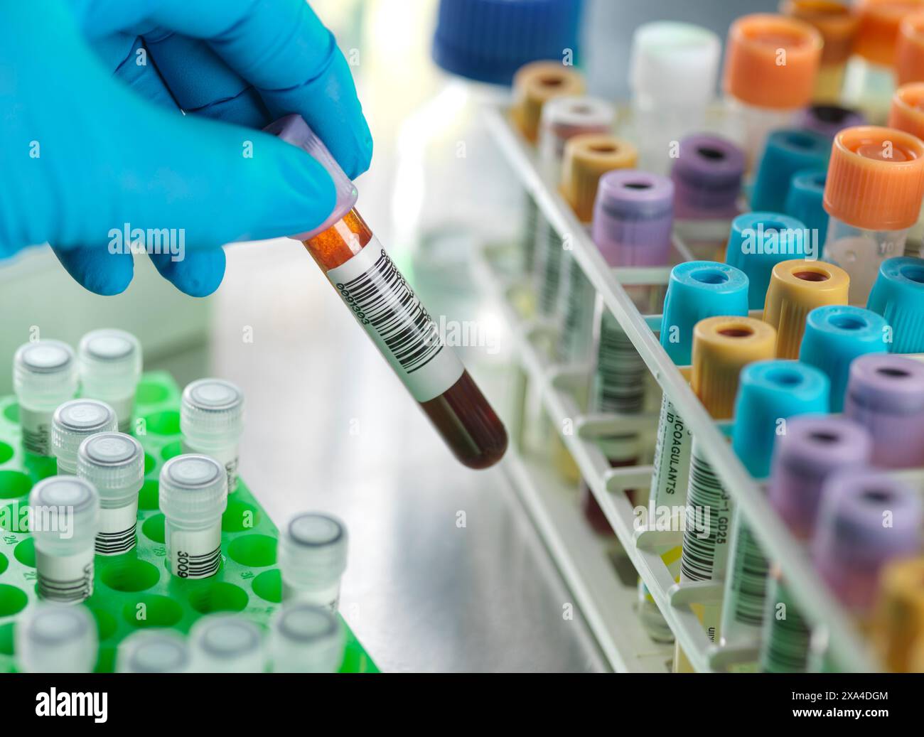 Medical Screening, Scientist preparing a blood sample for automated ...