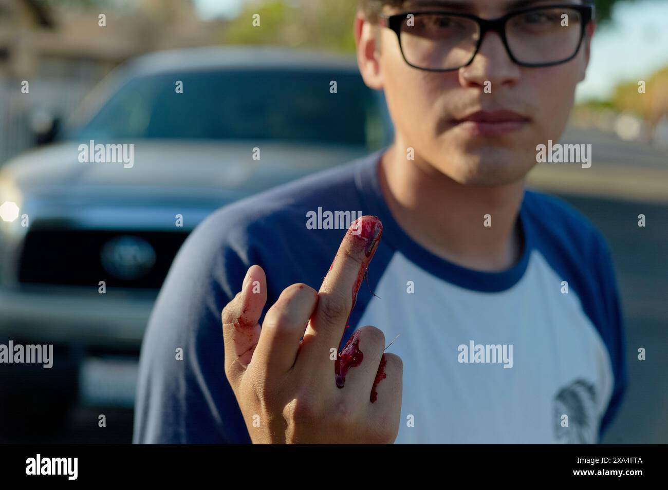 A man is holding up his injured finger, which is bleeding, with a ...