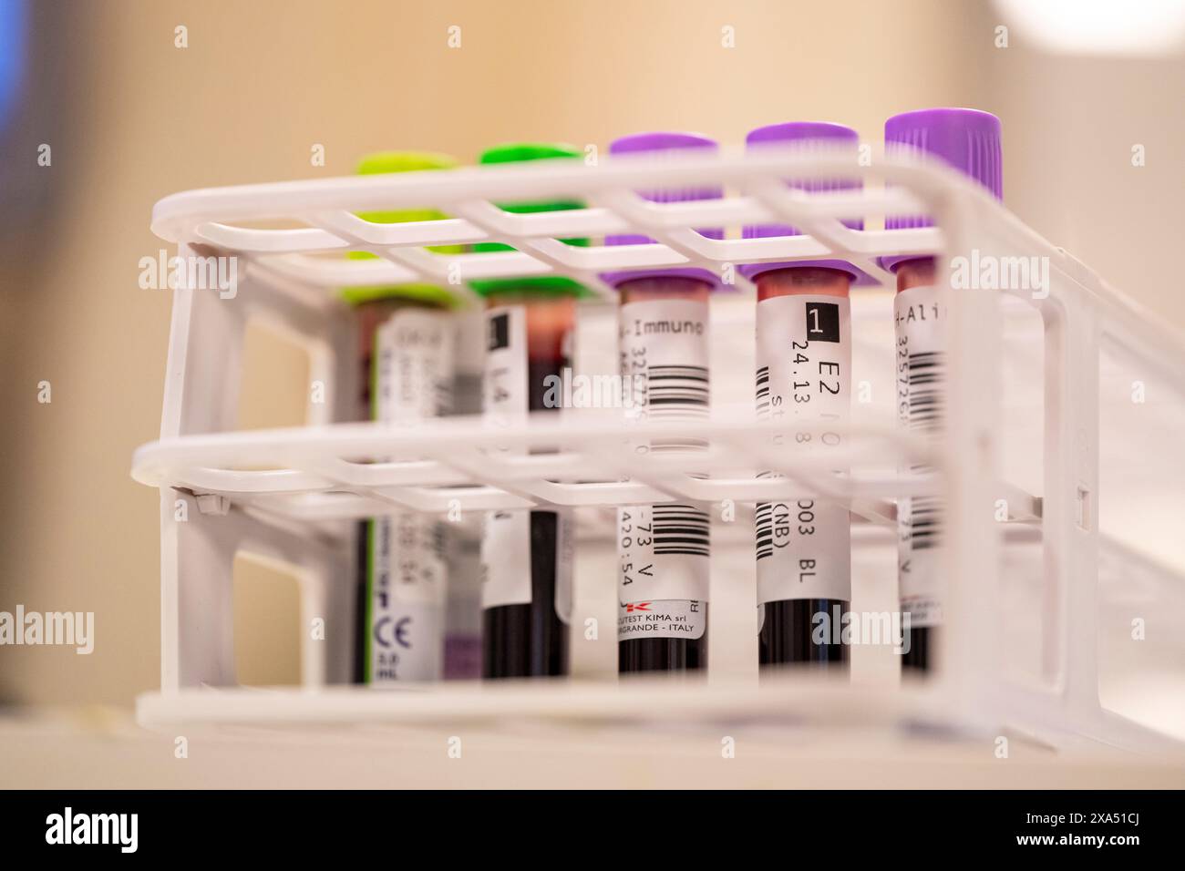 Laboratory diagnostics hi-res stock photography and images - Alamy