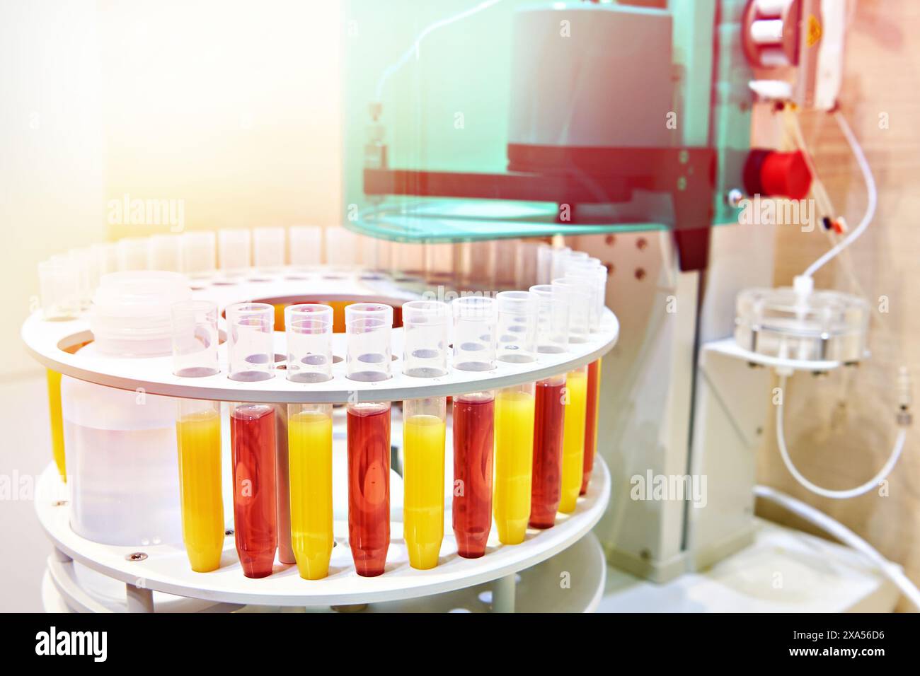 Professional laboratory sample processor pump. Automation in ion ...