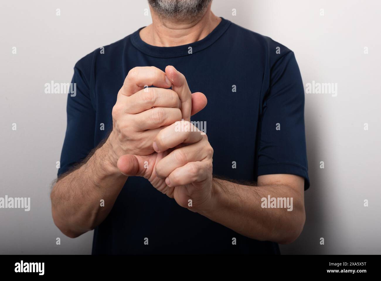 Middle-aged man scratching his finger. Skin disease. Allergic reaction ...