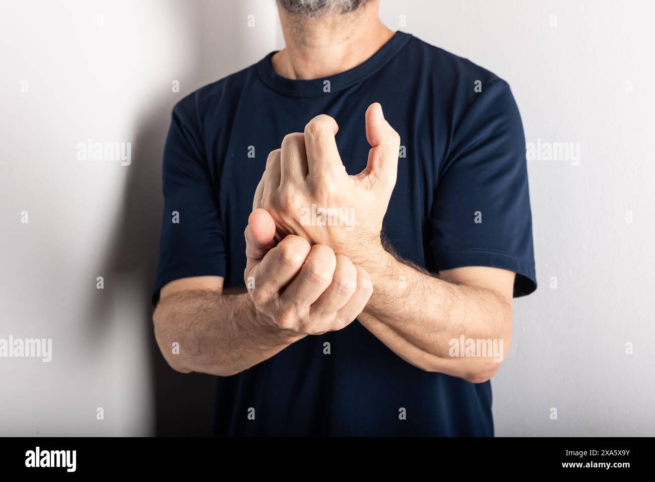 Middle aged man scratching his hand. Skin disease. Allergic reaction ...