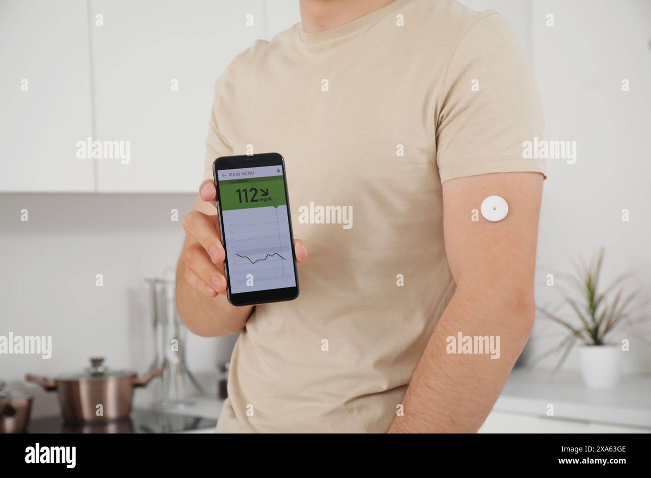 Diabetic young man with glucose sensor and mobile phone measuring blood ...