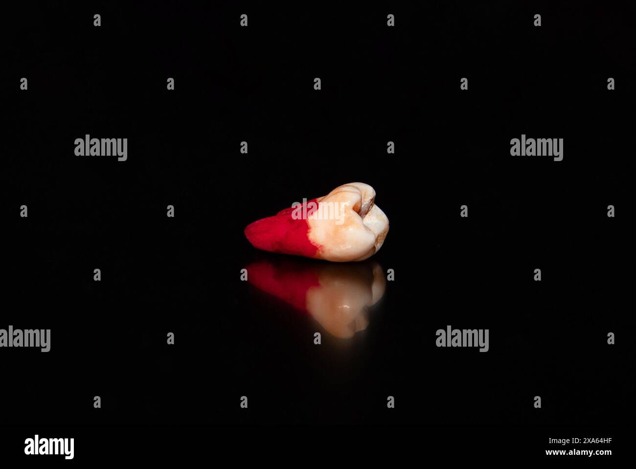 A single molar tooth just extracted against a black backdrop Stock ...